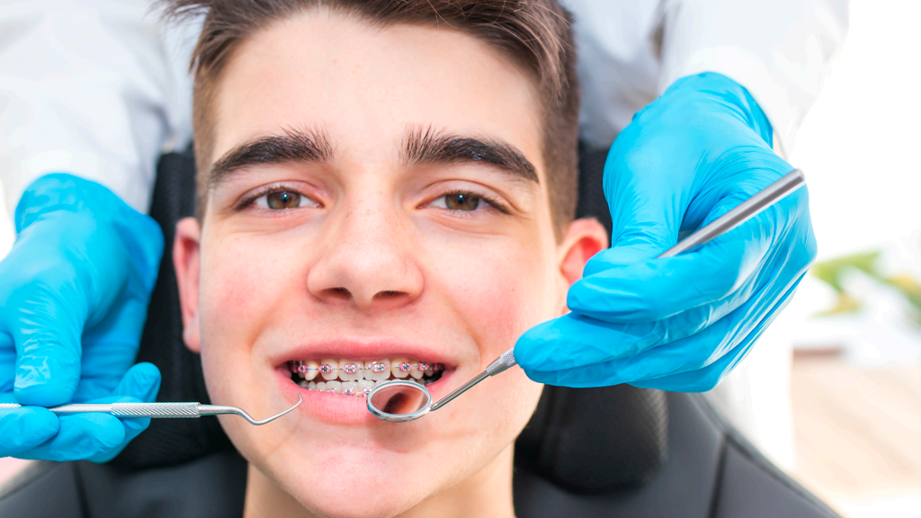 Brackets precio en Argentina: tipos de ortodoncia y opciones estéticas